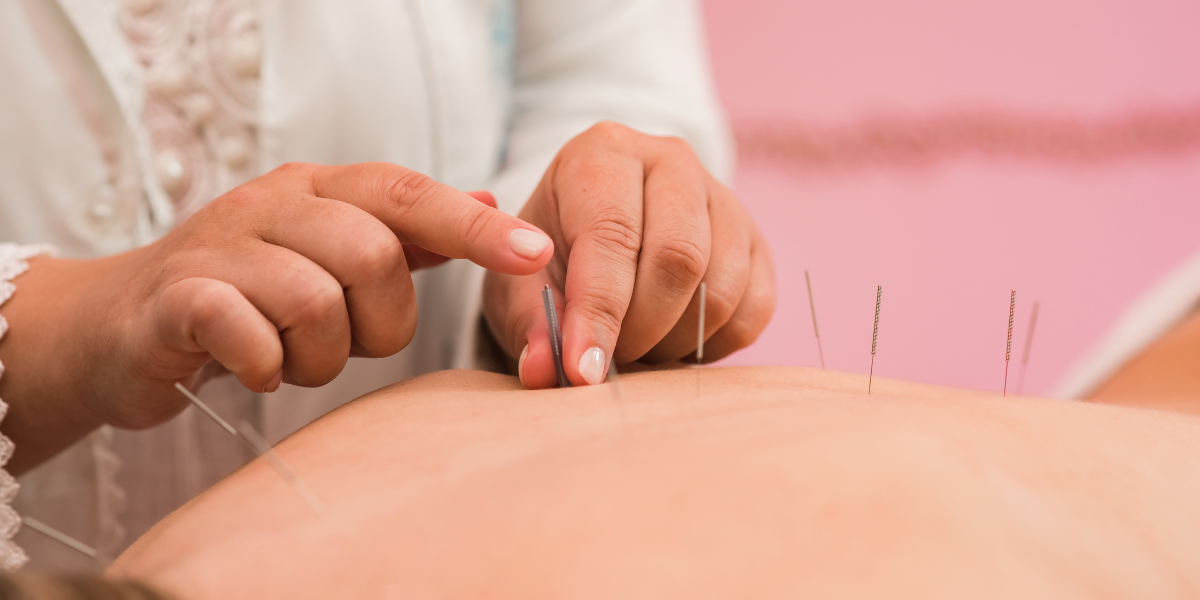 Practical Skills from Our Acupuncture Diploma Program | Pharma Medical